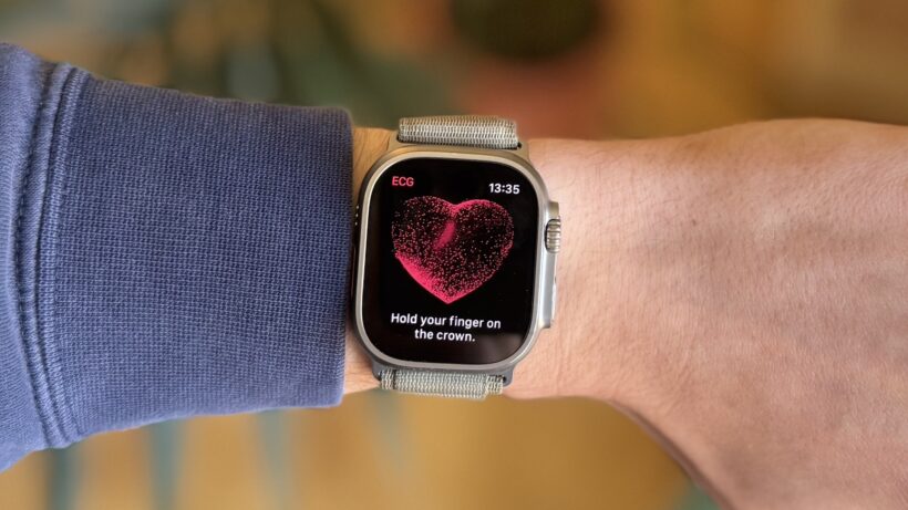 Best ECG smartwatch: Our experiences and ECG explained - Wareable