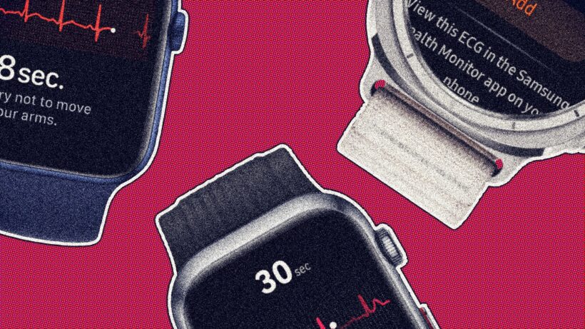 Best ECG smartwatch: Our experiences and ECG explained - Wareable